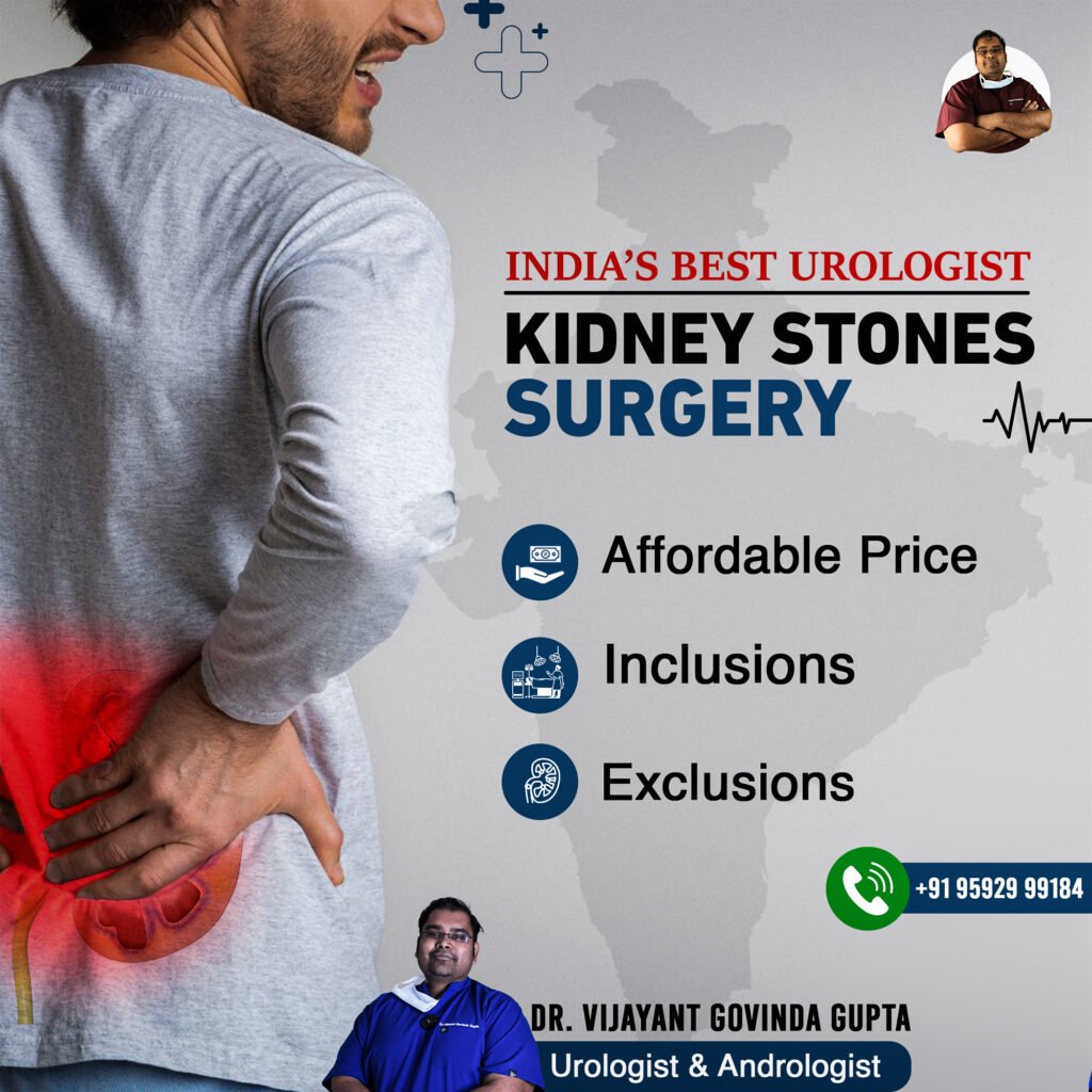 Kidney Stone Treatment in Delhi - Dr. Vijayant Govinda Gupta