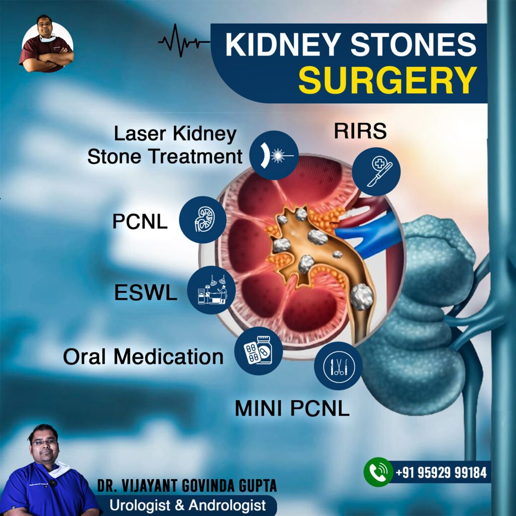 Kidney Stone Treatment in Delhi - Dr. Vijayant Govinda Gupta