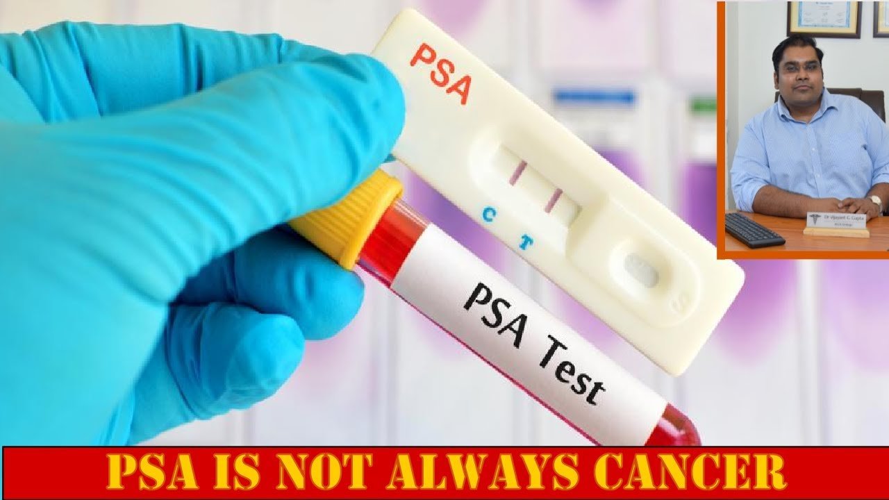 PSA Test For Prostate Cancer Screening And Diagnosis In Delhi