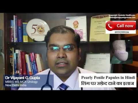 Pearly Penile Papules (PPP) Treatment In Delhi, India