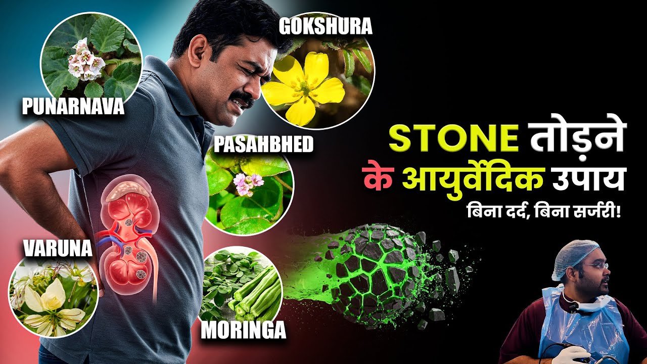 Ayurvedic Remedies for Kidney Stones: A Detailed Guide | Blog